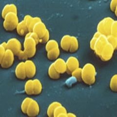 BIOLOGI GONZAGA: SOAL BAKTERI GANGGANG BIRU