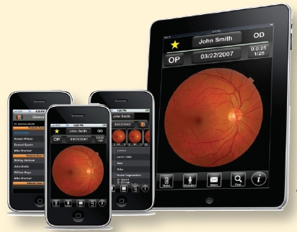 The Mission of My Vision Express