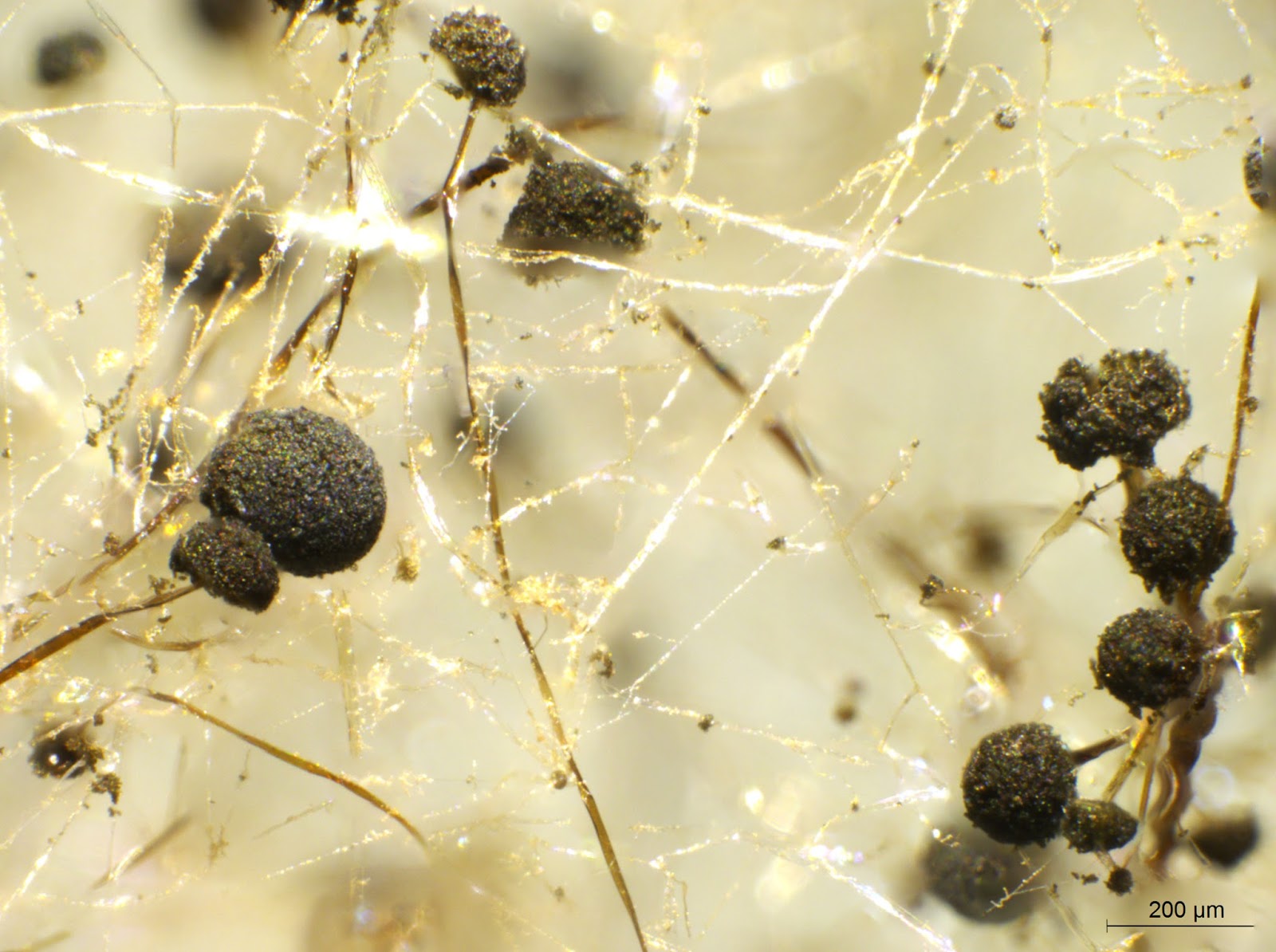 Black Bread Mold Under Microscope