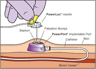 Blogging Life: The Port: He Love-Hates It