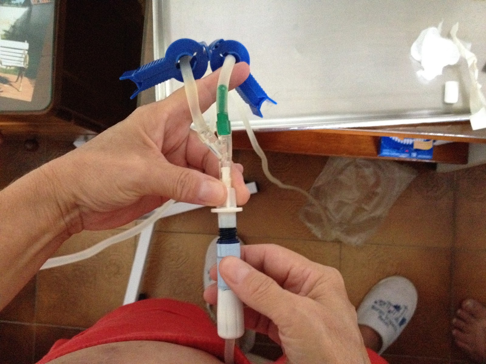 Diálise Peritoneal Ambulatorial Contínua - CAPD - Passo a passo