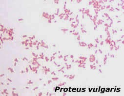 Proteus vulgaris ~ Kesehatan dan Olahraga
