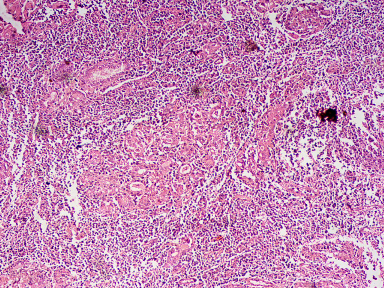 into the roots: Some thyroid lesions