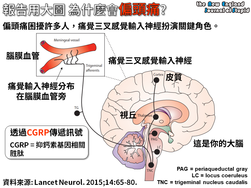 臨床藥學 報告用大圖 為什麼會偏頭痛 Pathophysiology And Sex Difference Of Migraine Nejs