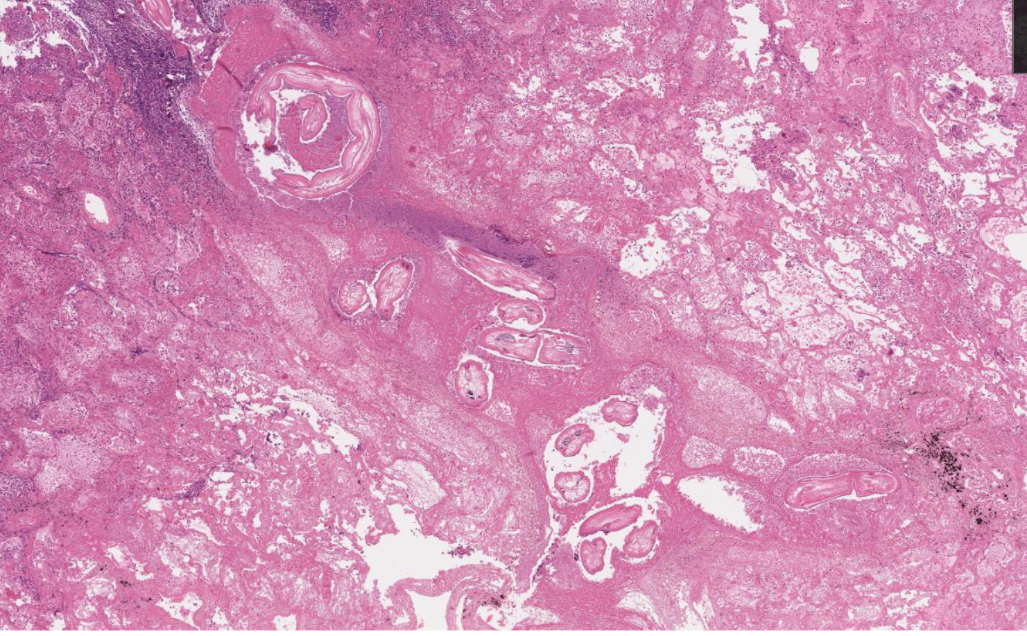 Creepy Dreadful Wonderful Parasites: Case of the Week 486