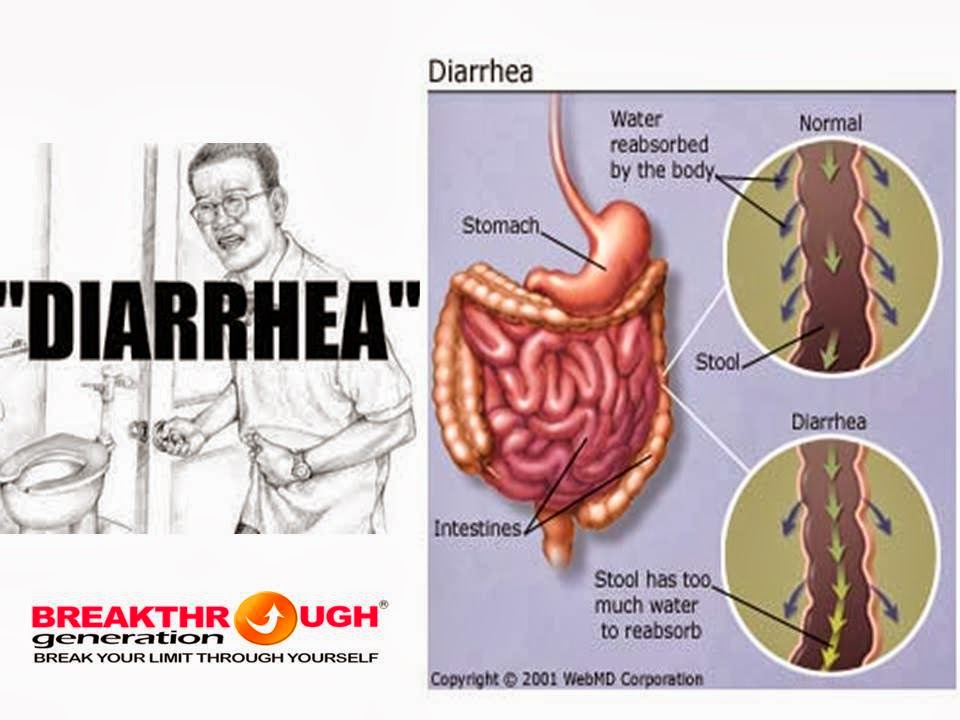 MIRACLE HAPPENS...AGAIN and AGAIN: DIARE JANGAN DIANGGAP ENTENG ...