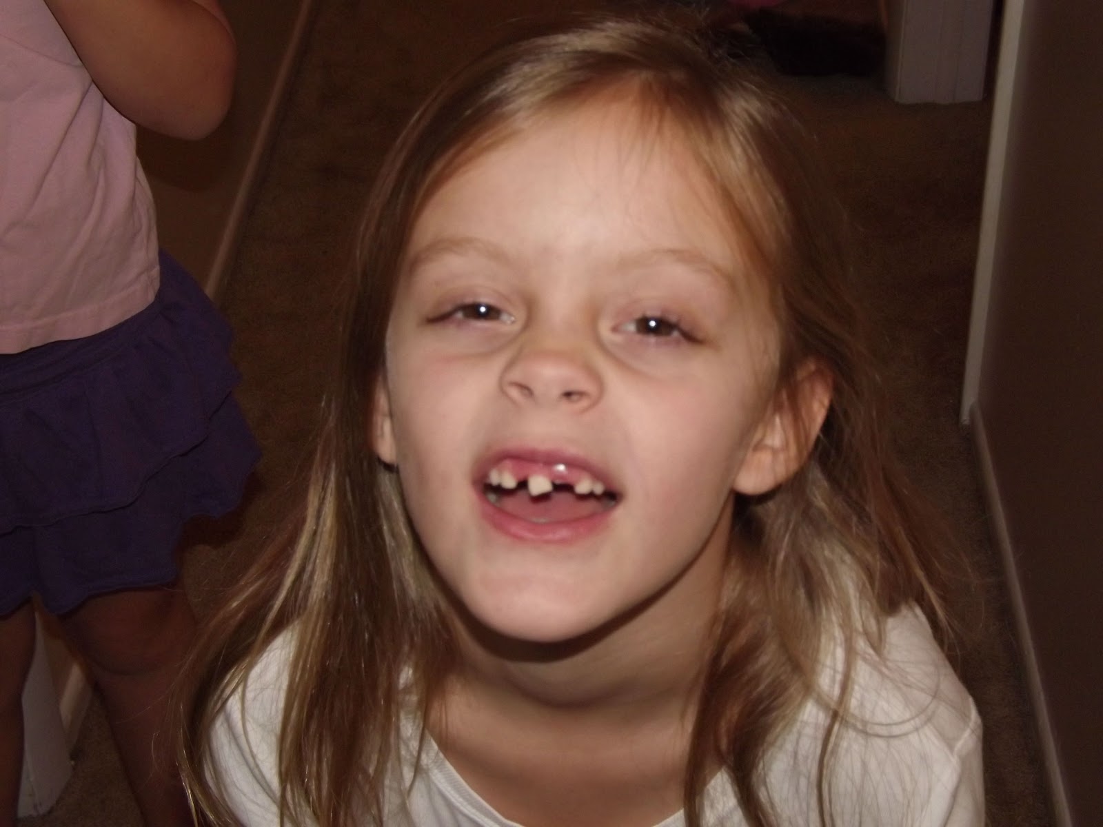 Country Fried Family: Snaggletooth