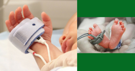 Newborn screening for critical congenital heart disease using pulse ...
