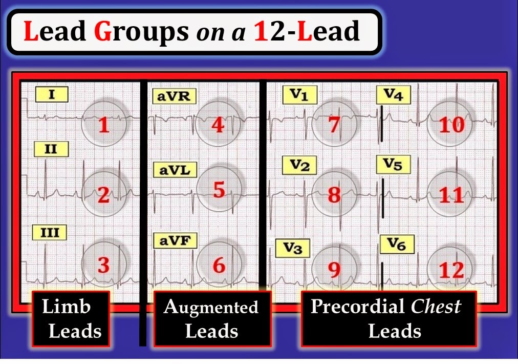 ecg-interpretation-ecg-blog-91-basic-concepts-4-lead-groupings