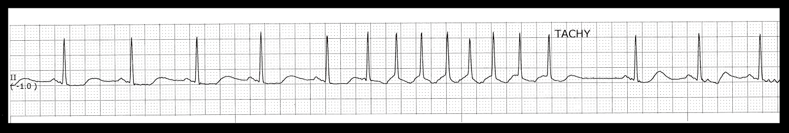 Practice EKG Strips 339