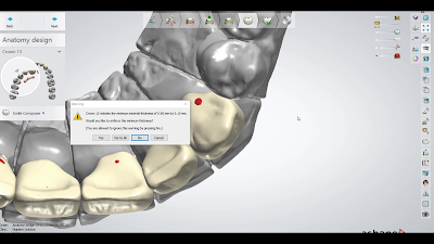convert stl files into dcm with 3shape dental systen