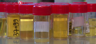 traitement de l'insuffisance rénale: Qu'est-ce que l'urine de mousse ...