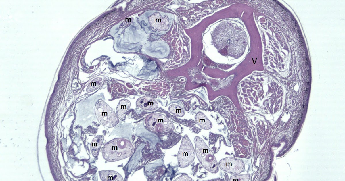 Parasite of the Day: Alaria spp.