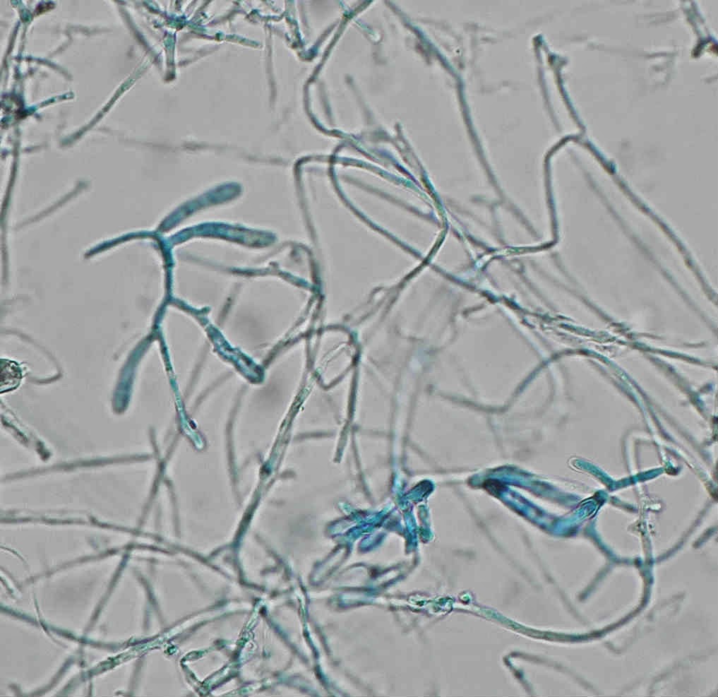 ATLAS MICOLOGIA: EPIDERMOPHYTON FLOCCOSUM
