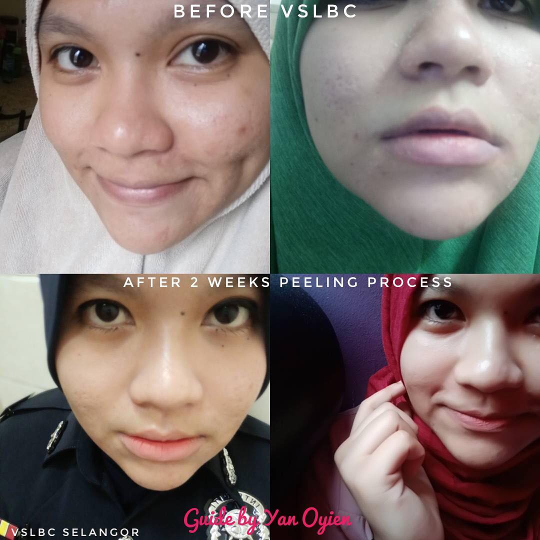 PRODUK PEMUTIH DAN PENGELUPASAN VSL BEAUTY CARE