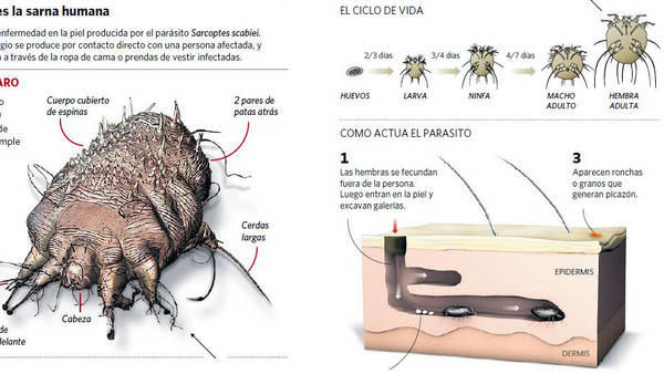 la educación de hoy en dia: Sarna...