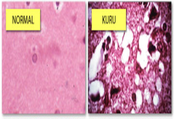 Humerus Revelations of the Naked Ape: Eat Me! Exploring the Costs ...