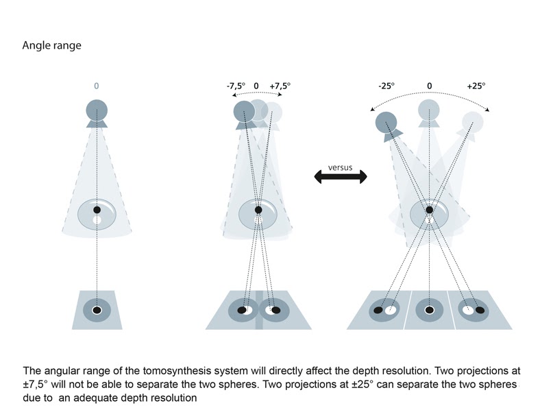 Tecnicos Radiologos: Tomosíntesis de mama. Cómo Funciona