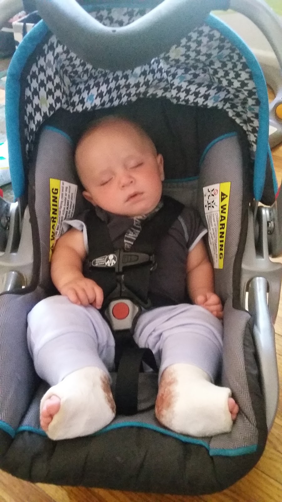 Andrew, Jonathan & Alexander: Baby with Casts