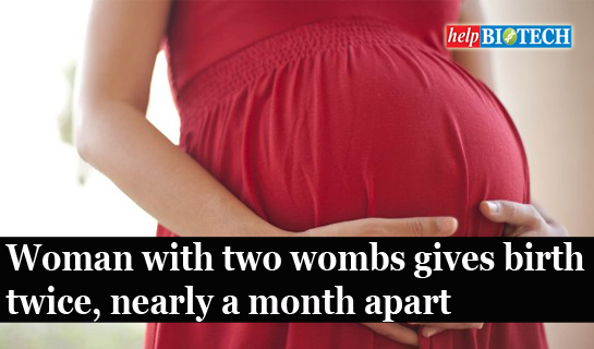Woman with two wombs gives birth twice, nearly a month apart