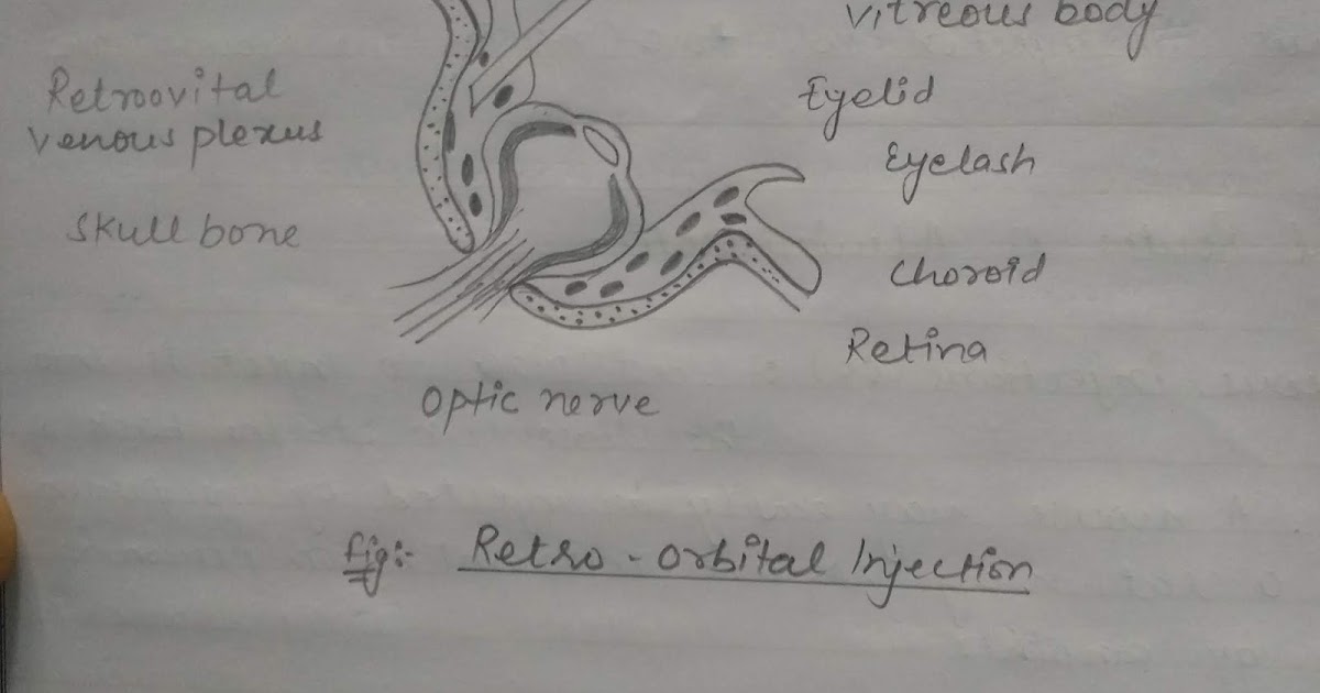 Retro orbital injection diagram