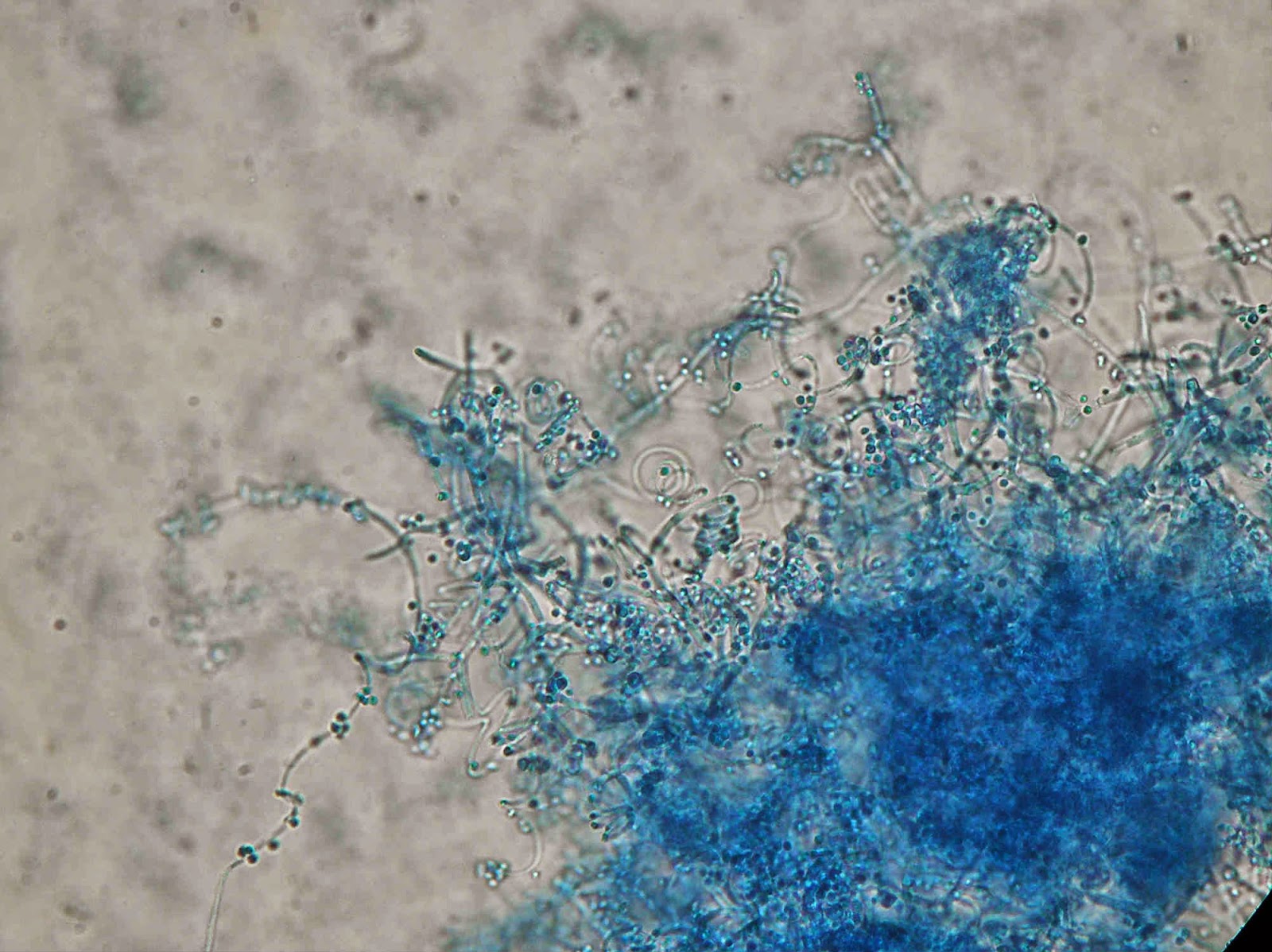 ATLAS MICOLOGIA: A IMPORTÂNCIA DA MICROSCOPIA NA IDENTIFICAÇÃO DOS ...