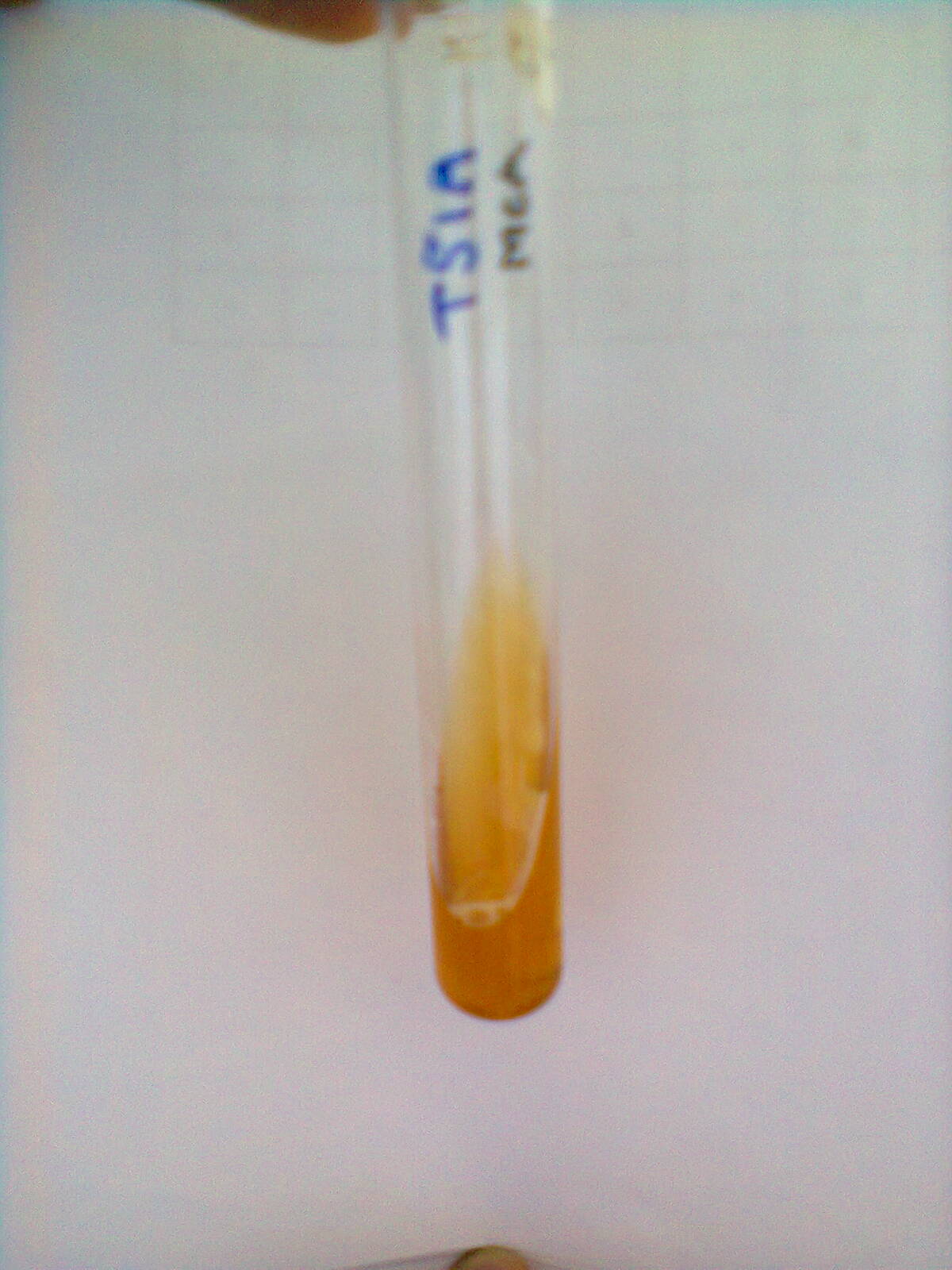 Teenoz Health Analyst: Gambar Hasil Identifikasi Klebsiella