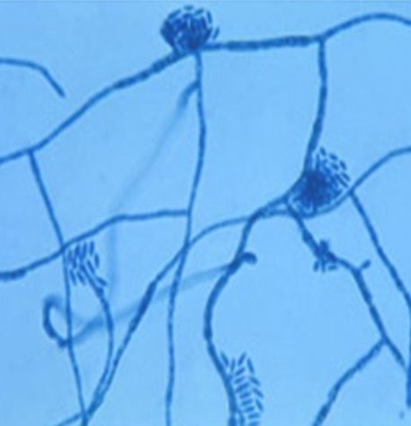 Micosis Humana: Tipos de Dermatomicosis