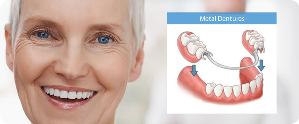 permanent dentures cost