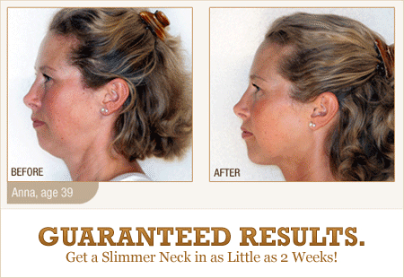 Welcome to Perleetdou - Collection Fun !! : Neckline Slimmer Makes You ...