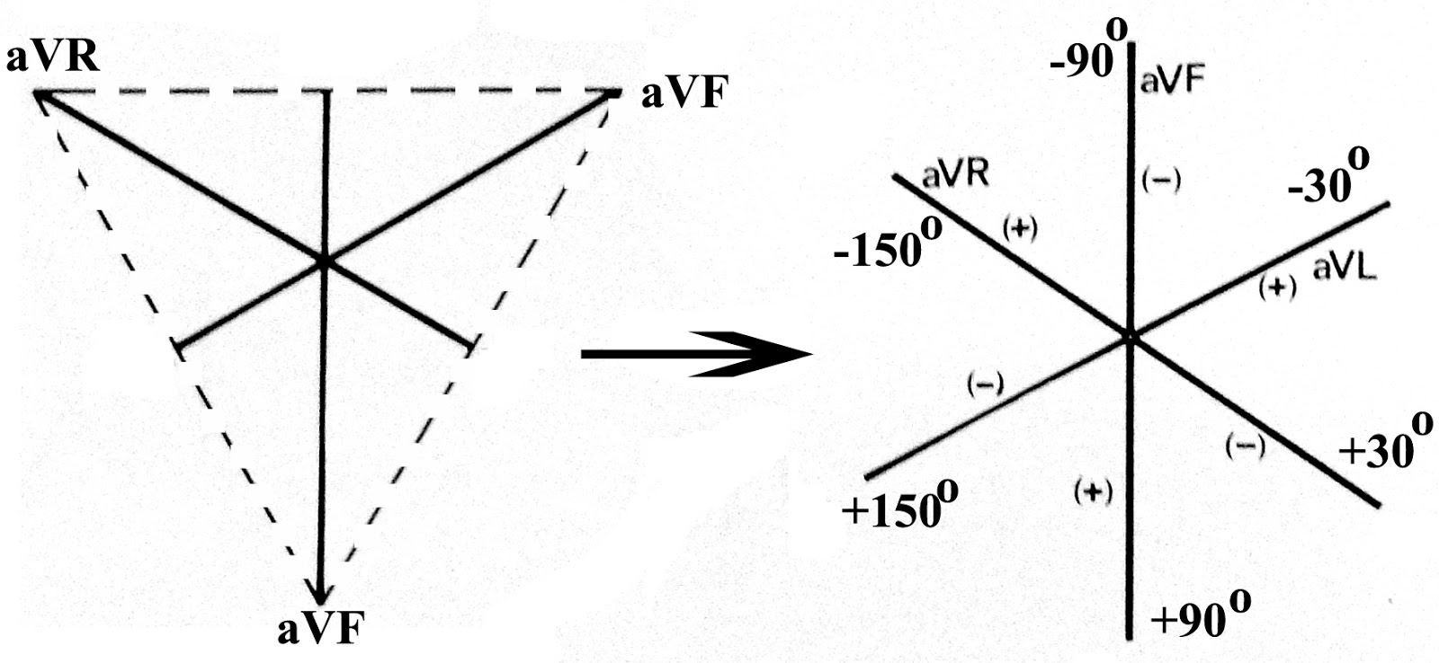Electrocardiografie Veterinara: Axul electric cardiac