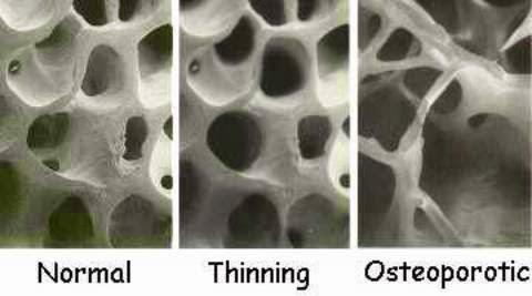 Bad Effects Of Smoking