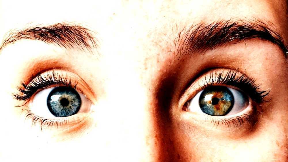 Heterochromia iridum