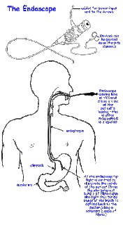 Biomedical Engineering: Endoscopes Preventive Maintenance