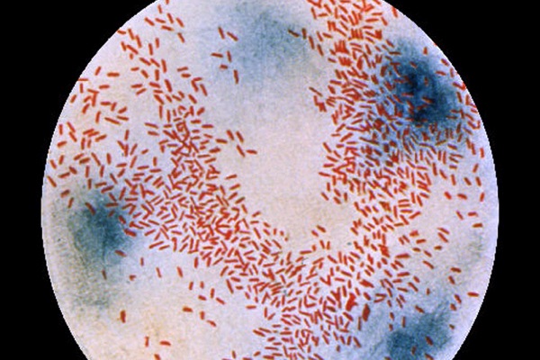 Haemophilus influenzae - Análises Clínicas.com