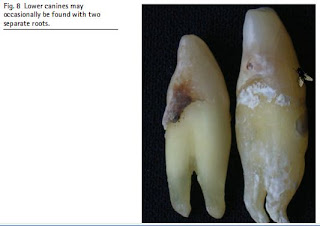 Endodontic: MANDIBULAR CANINE