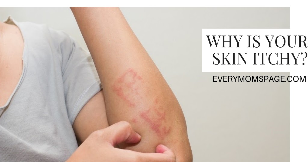 Why Is Your Skin Itchy?