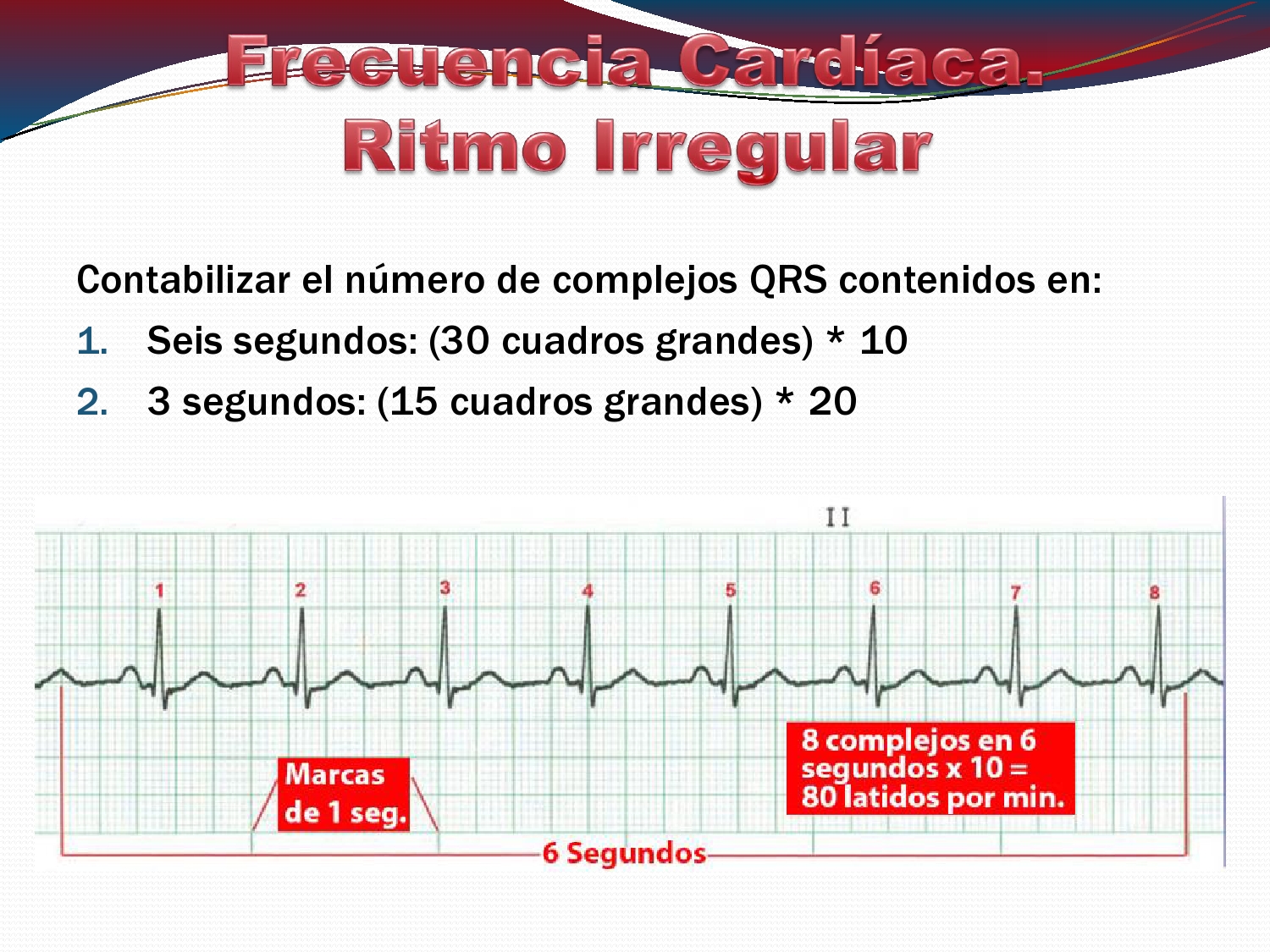 TEMAS MÉDICOS: ELECTROCARDIOGRAMA NORMAL