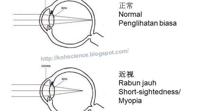 Explore to Koh's Science World ( Blog Sains): Rabun Dekat , Rabun Jauh