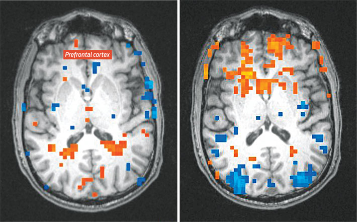 Vision IRM: Un nouveau détecteur de mensonge?