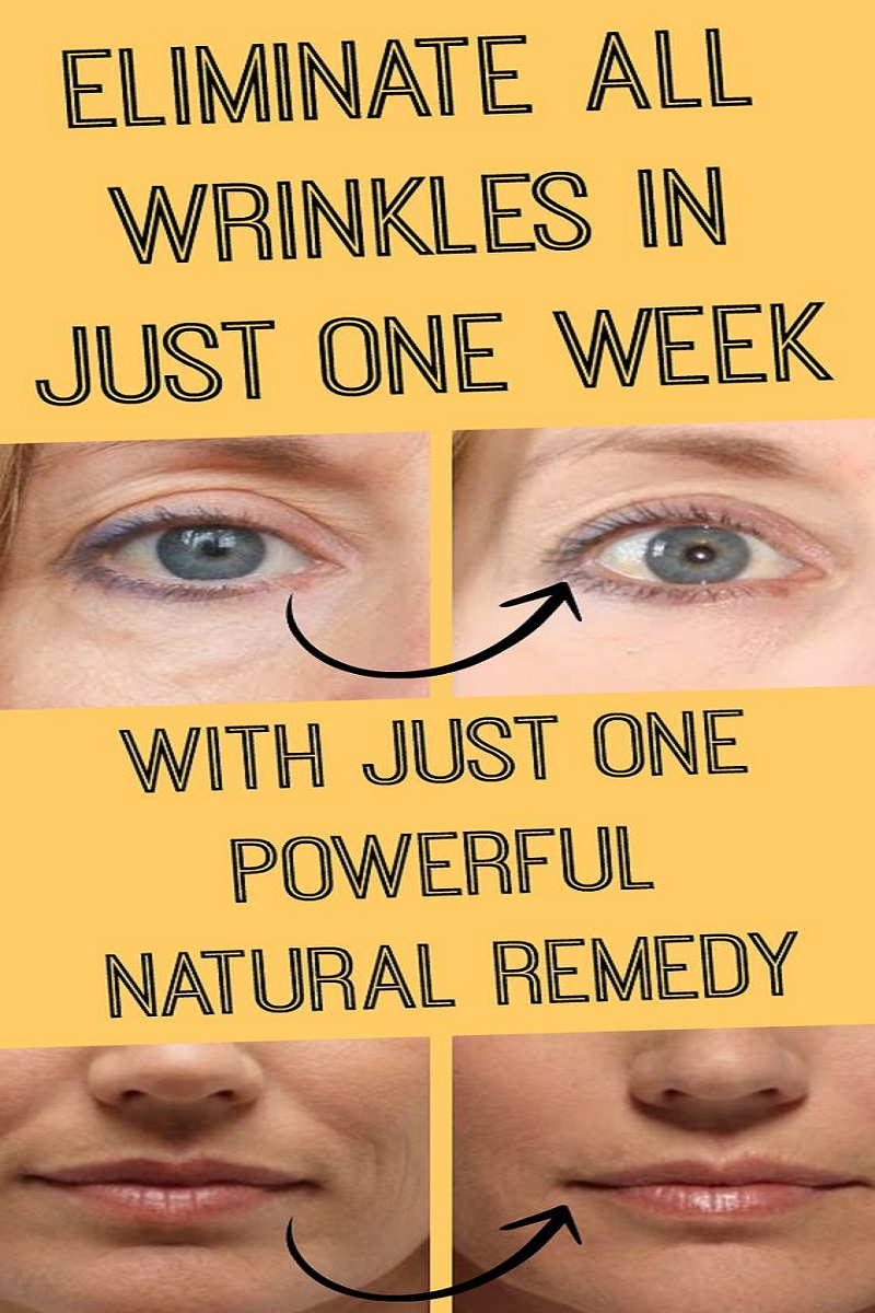 Powerful Natural Remedy That Eliminates All Wrinkles in One Week! | No ...