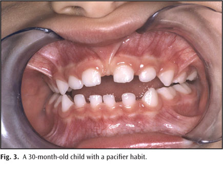 Klinik Gigi Anak dan Behel Gigi | Kidz Dental Orthodontic Clinic ...