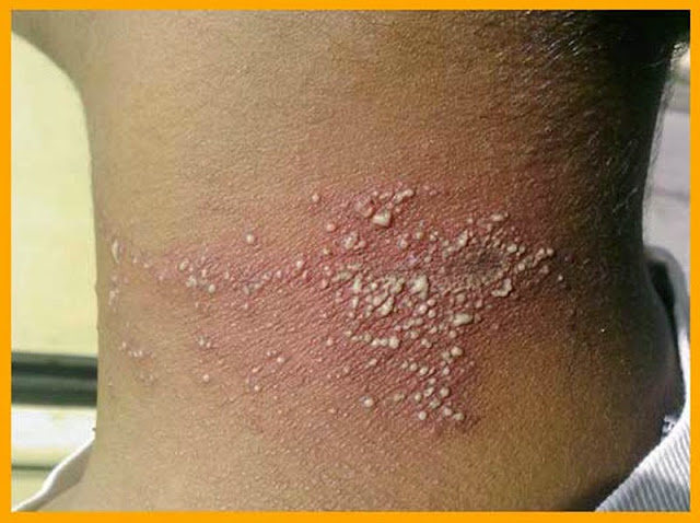 Tomcat bahaya gigitan tomcat dan pencegahan - Baritoko