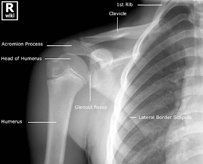 Humerus X Ray Anatomy