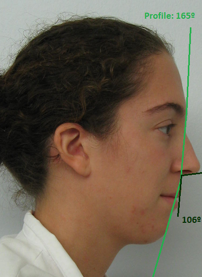 Dentistry: Facial Analysis