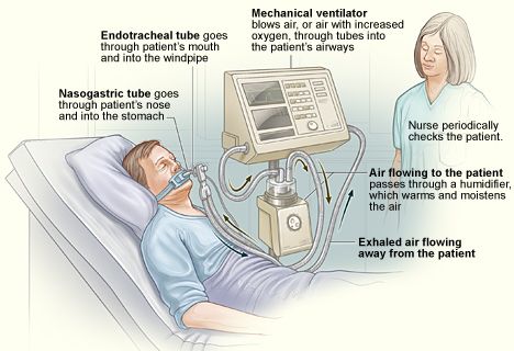 MEDICAL EQUIPMENT: Ventilator Machine Respironics Philips