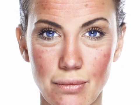 SHJ Women's Health Specialist: Your Skin and Photo-Aging and why we ...