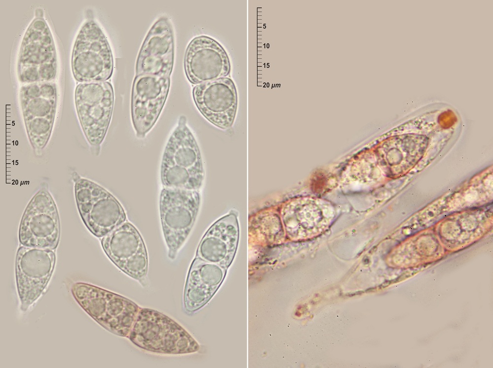 Juglanconis appendiculata Voglmayr & Jaklitsch • CEMAS hongo patógeno ...