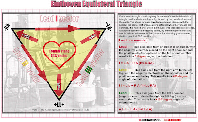 ECG Educator Blog : 10/03/17