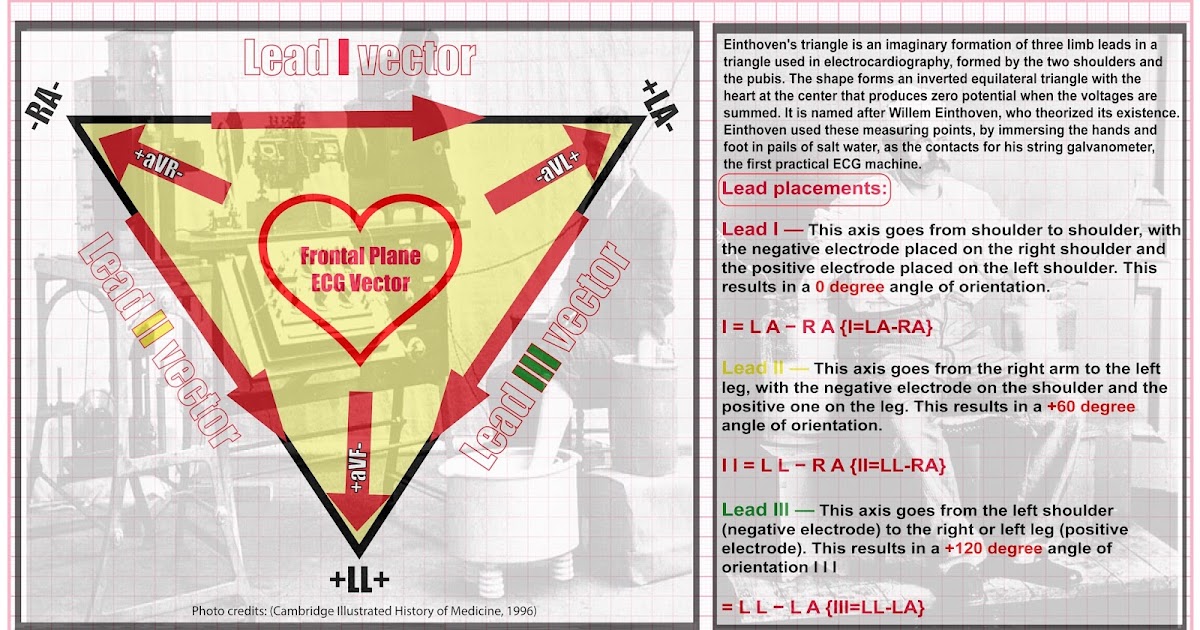 ECG Educator Blog : Einthoven's triangle
